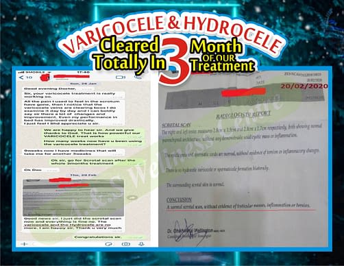 PROVEN CURE FOR HYDROCELE WITHOUT SURGERY – I. A. & S. Natural Medicare ...