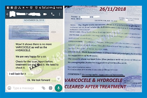 PROVEN CURE FOR HYDROCELE WITHOUT SURGERY – I. A. & S. Natural Medicare ...