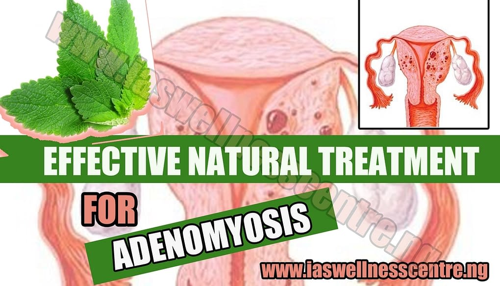 EFFECTIVE NATURAL TREATMENT FOR ADENOMYOSIS IN NIGERIA - I.A.S Wellness ...